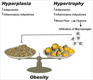 Difference Between Hypertrophy and Hyperplasia | Difference Between ...