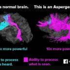 Difference Between | Tag archive for High Functioning Autism | High ...