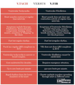 Difference Between Ventricular Tachycardia (Vtach) and Ventricular ...