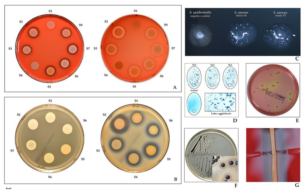 Difference Between Bioburden and Microbial Limit Test | Difference Between