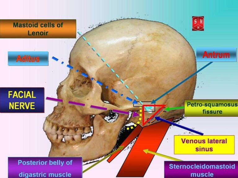 Difference Between Mastoiditis and Otitis Media | Difference Between ...