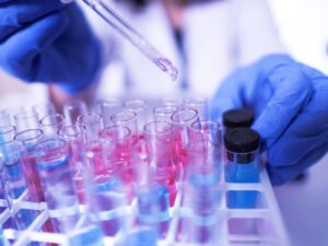 Difference Between Convalescent Plasma Therapy and Hyperimmune Globulin ...