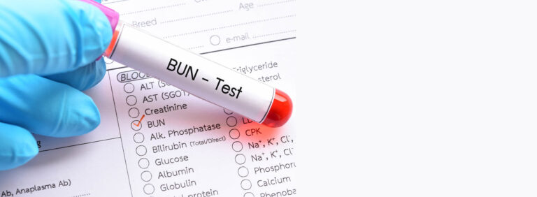 Difference Between Blood Urea Nitrogen BUN and Creatinine | Difference ...