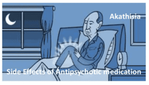 Difference Between Akinesia and Akathisia | Difference Between ...