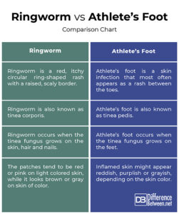Difference Between Ringworm and Athlete’s Foot | Difference Between ...