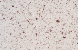 Difference Between Platelet Agglutination and Aggregation | Difference ...