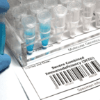 Difference Between | Tag archive for Immunodeficiency | Immunodeficiency