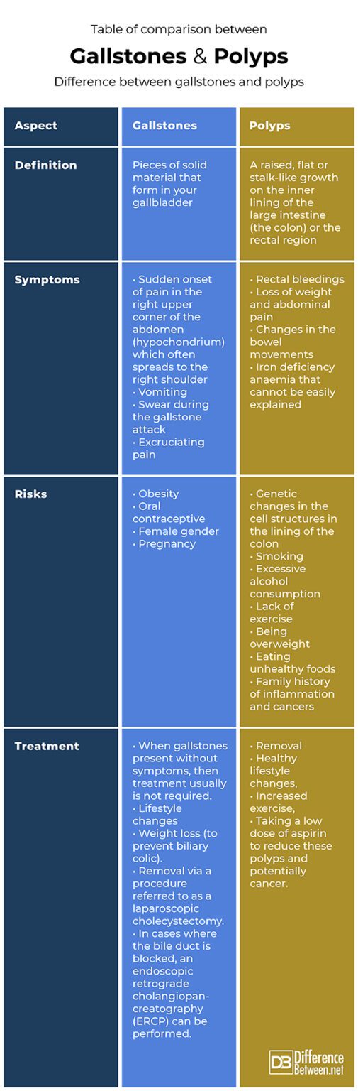 Difference Between Gallstones and Polyps | Difference Between ...