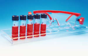 Difference Between Supernatant and Precipitate | Difference Between ...
