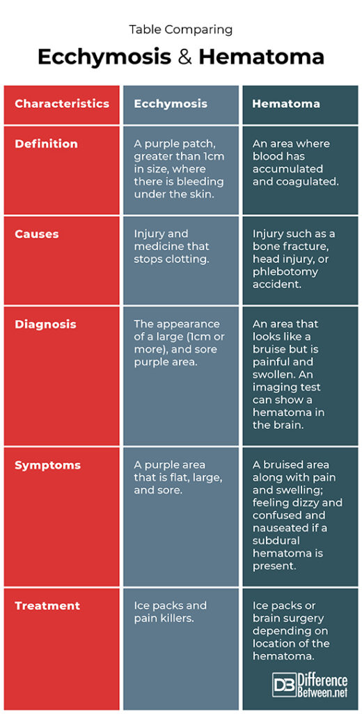 Difference Between Ecchymosis and Hematoma | Difference Between | Ecchymosis vs Hematoma