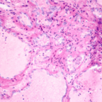 Difference Between | Tag archive for Hemangioma | Hemangioma