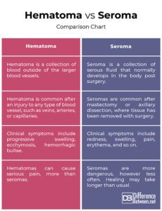 Difference Between Hematoma and Seroma | Difference Between | Hematoma ...