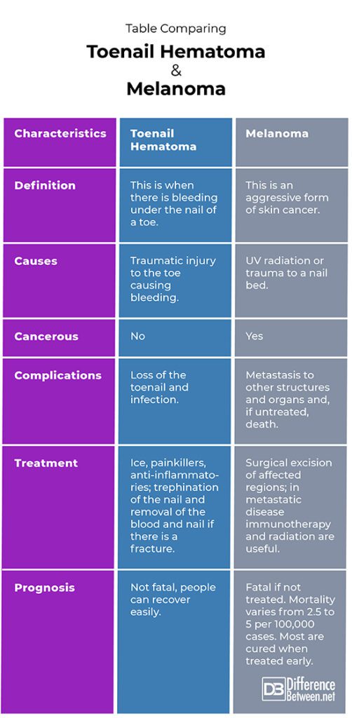 Difference Between Toenail Hematoma and Melanoma | Difference Between