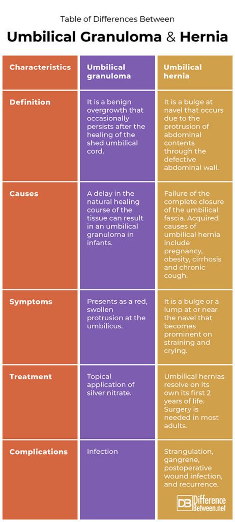 Difference Between Umbilical Granuloma and Hernia | Difference Between