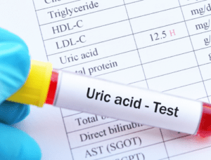 Difference Between Anomaly and Abnormality | Difference Between ...