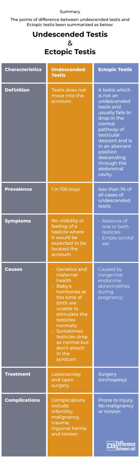 Difference Between Undescended Testis and Ectopic Testis | Difference ...