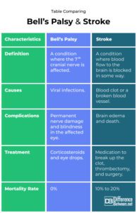 Difference Between Bell’s Palsy and Stroke | Difference Between | Bell ...