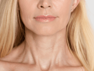 Difference Between Normal Neck and Goiter | Difference Between