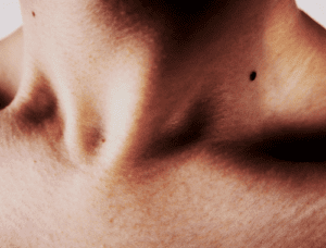 Difference Between Male and Female Collar Bones | Difference Between