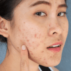 Difference Between | Archive for Articles Health | Health