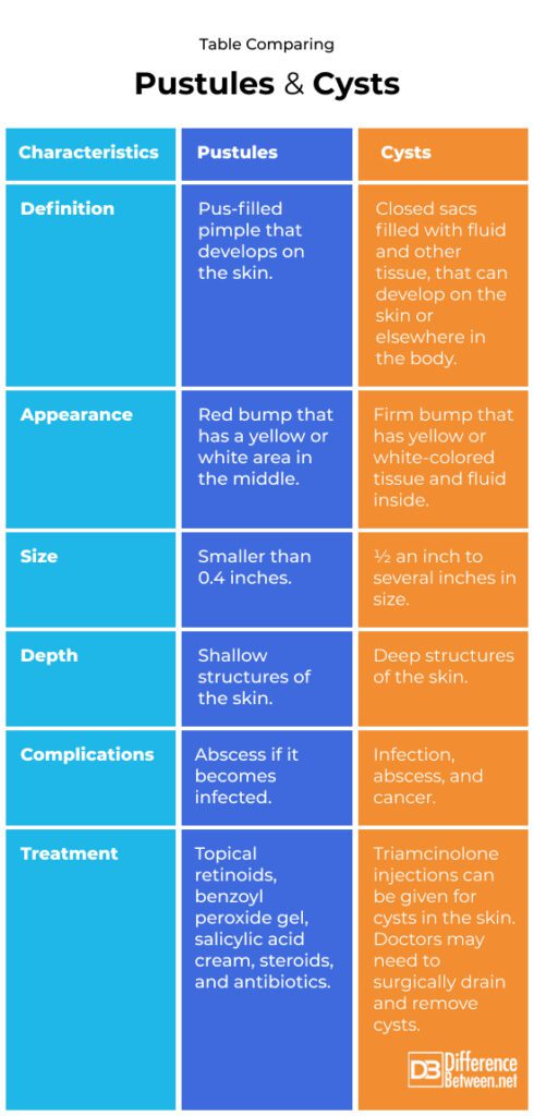 Difference Between Pustules and Cysts | Difference Between